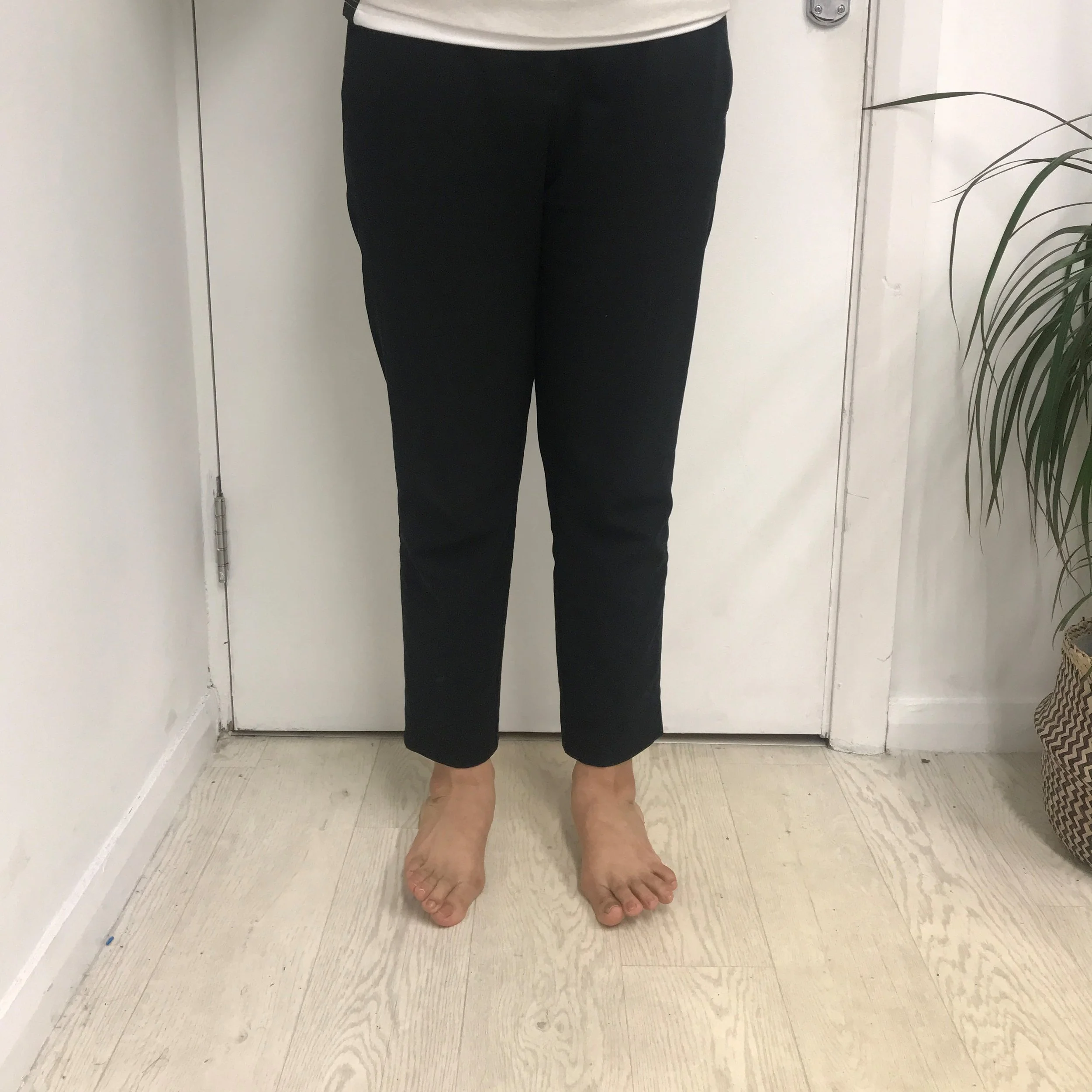 Why do I have dropped arches? - First Line Physio
