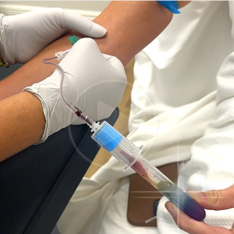 Estima PRF: Platelet-Rich Fibrin Explained — Estima Aesthetics