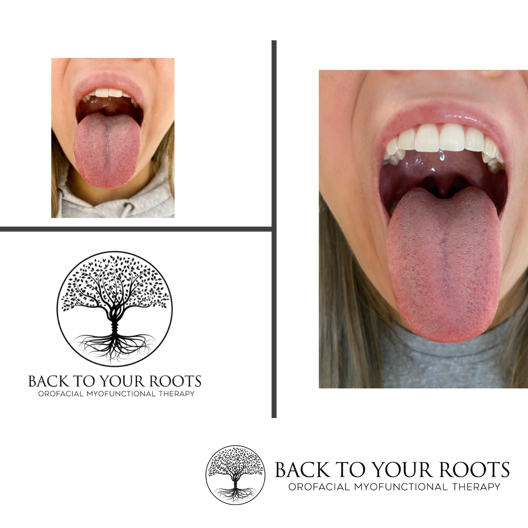 Back To Your Roots Orofacial Myofunctional Therapy/Kelly-Hall-RDH-OMT ...