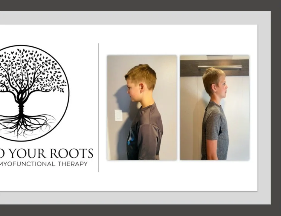 Back To Your Roots Orofacial Myofunctional Therapy/Kelly-Hall-RDH-OMT ...