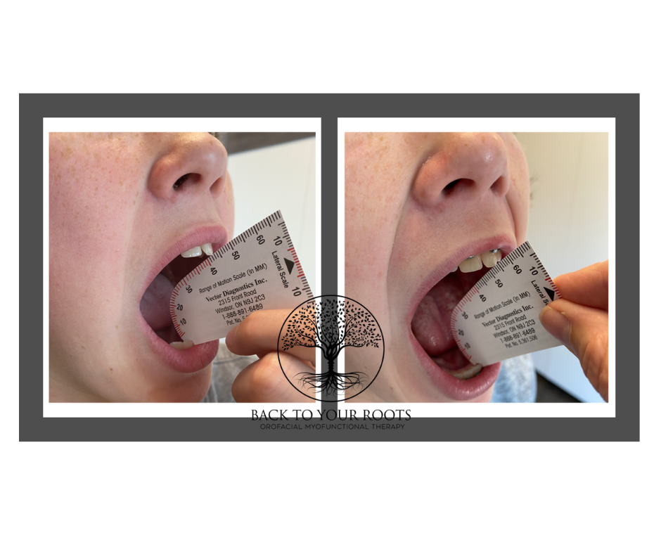 Back To Your Roots Orofacial Myofunctional Therapy/Kelly-Hall-RDH-OMT ...