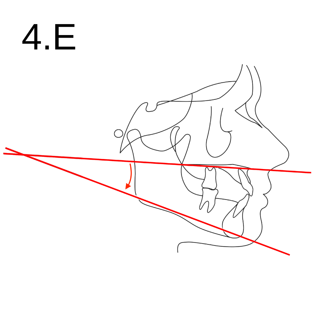 3) Cephalometry — Cephtactics Dental