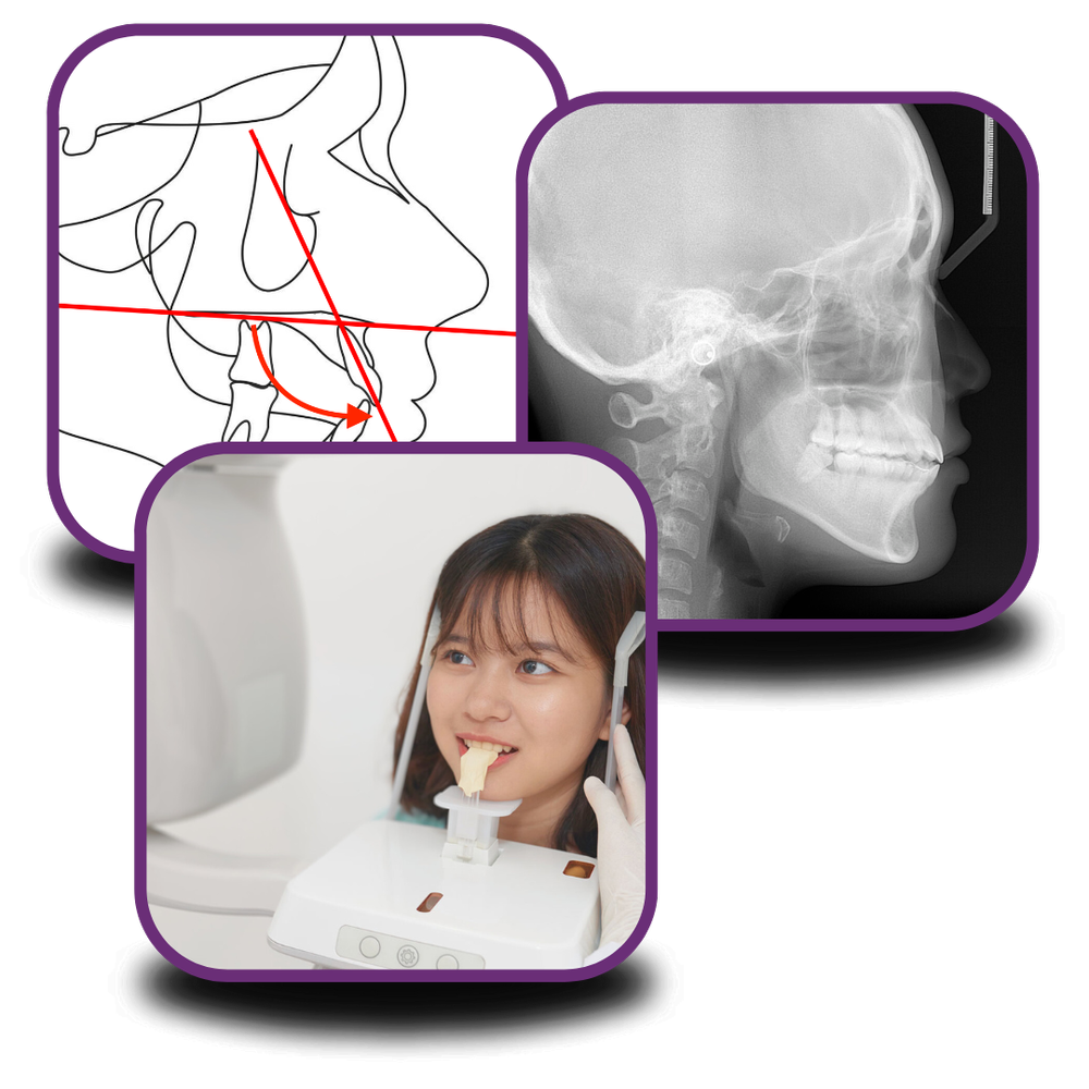 3) Cephalometry — Cephtactics Dental