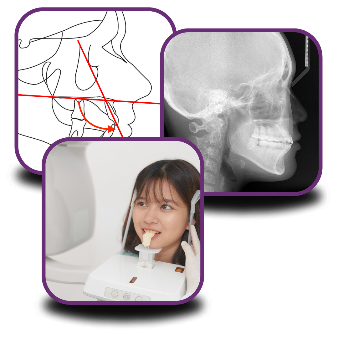 3) Cephalometry — Cephtactics Dental