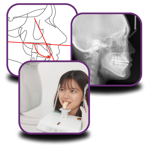3) Cephalometry — Cephtactics Dental