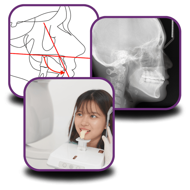 3) Cephalometry — Cephtactics Dental