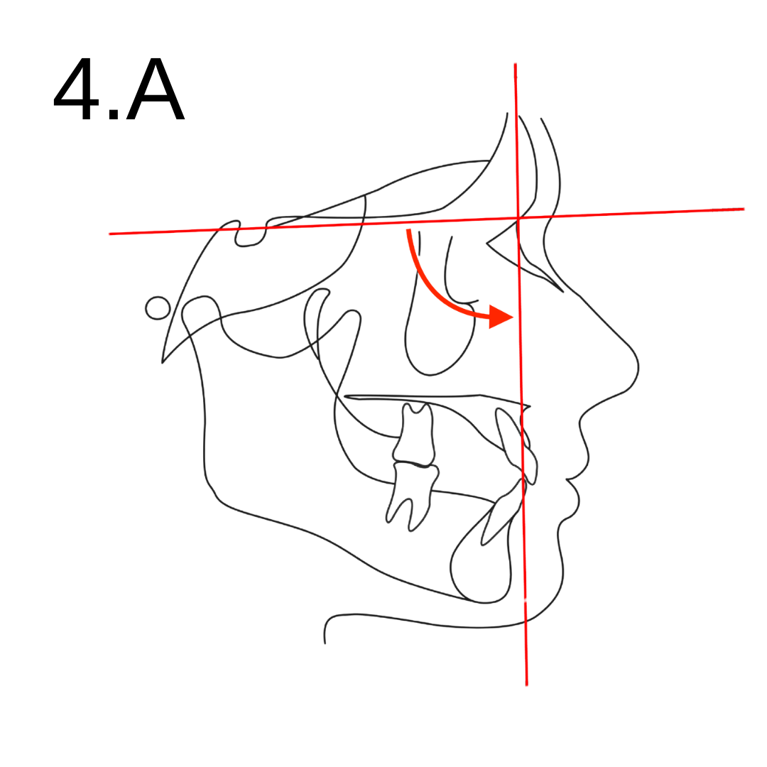3) Cephalometry — Cephtactics Dental