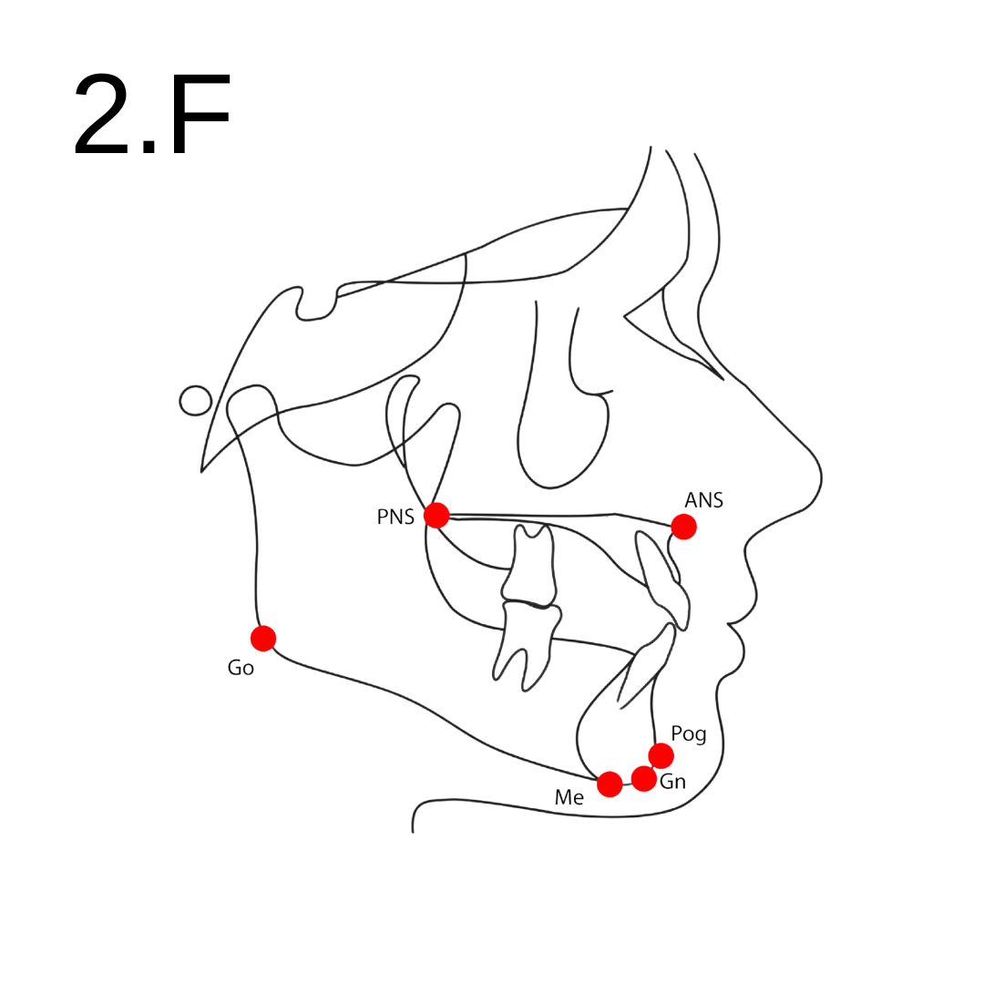 Optimize Orthodontic Diagnosis with Cephalometry Techniques ...