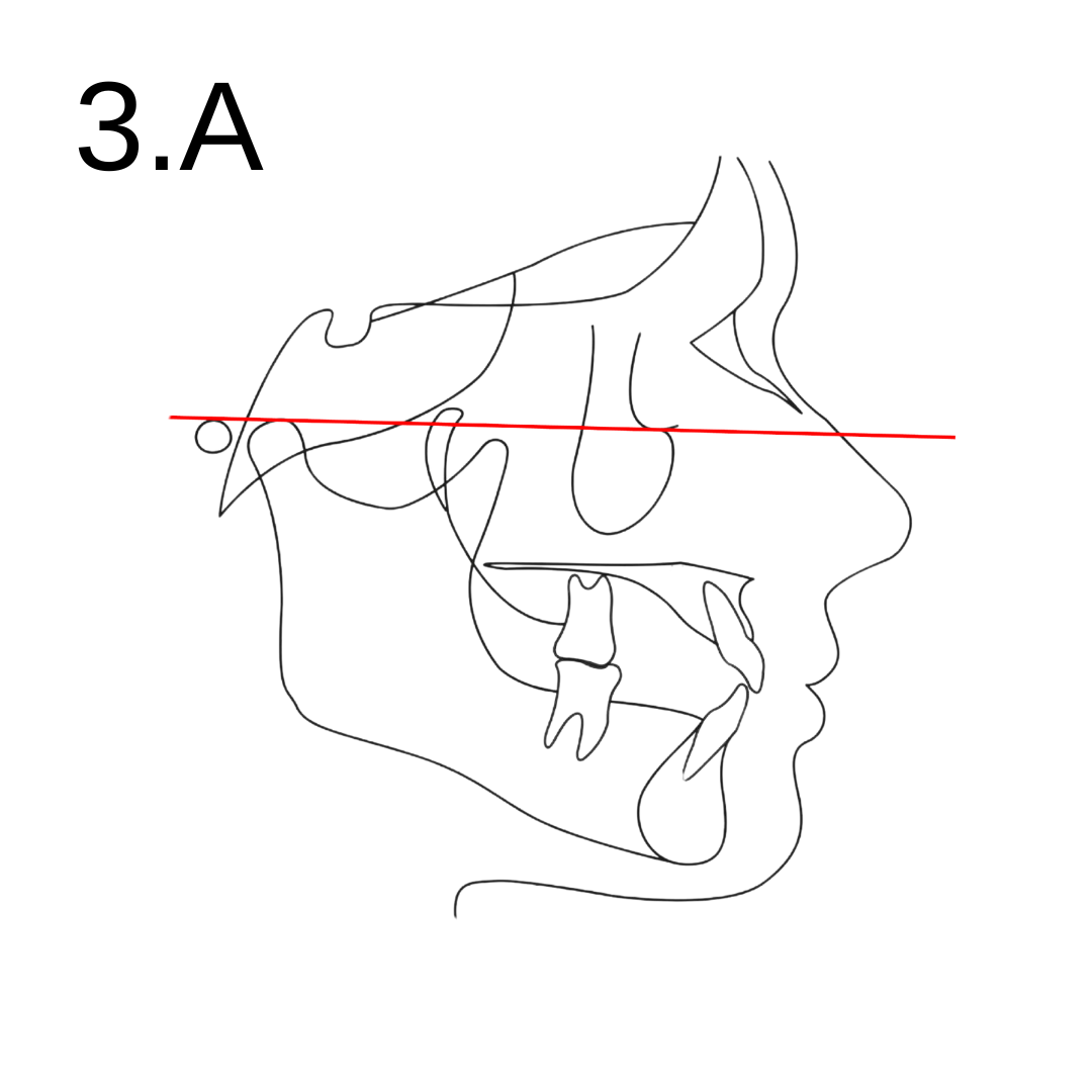 3) Cephalometry — Cephtactics Dental