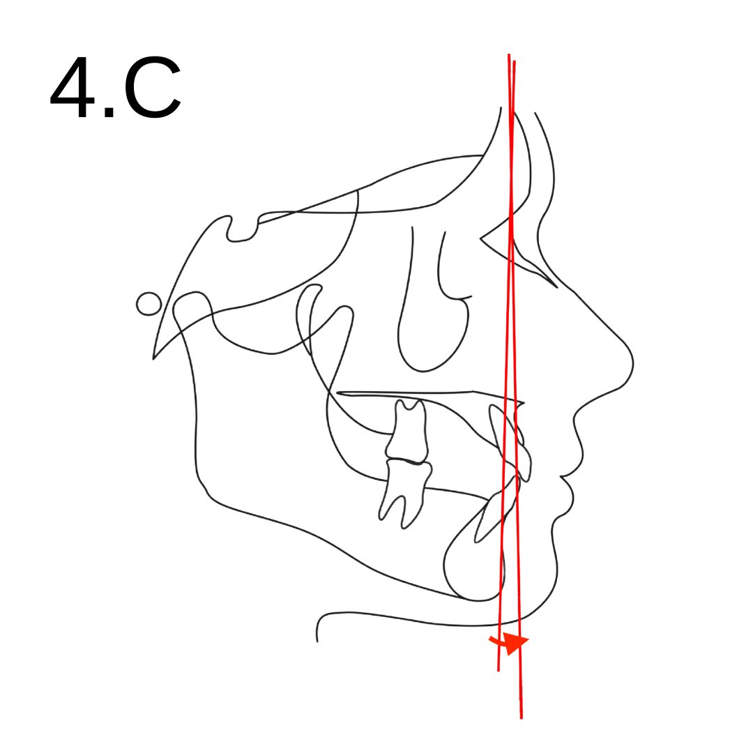 3) Cephalometry — Cephtactics Dental