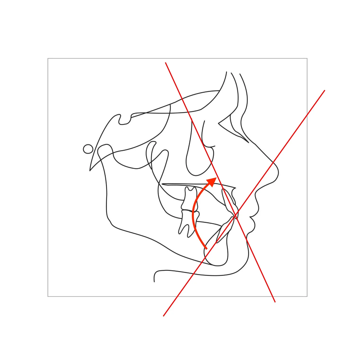 3) Cephalometry — Cephtactics Dental