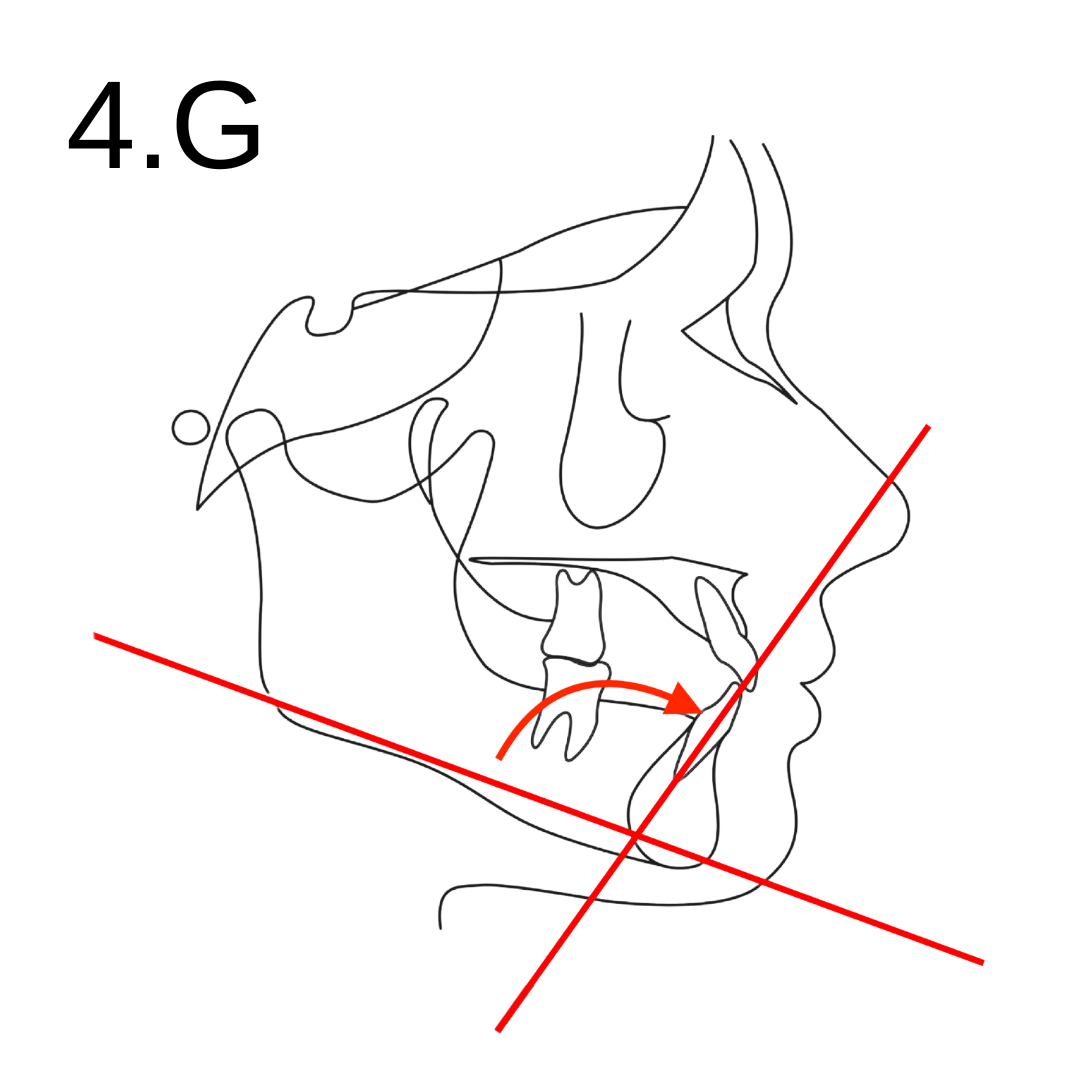 3) Cephalometry — Cephtactics Dental