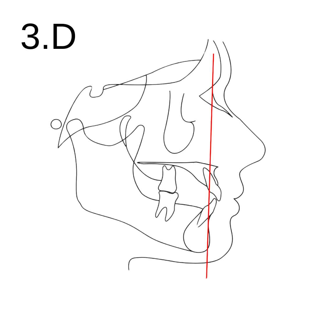 3) Cephalometry — Cephtactics Dental