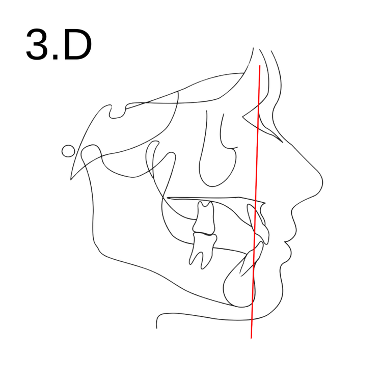 3) Cephalometry — Cephtactics Dental