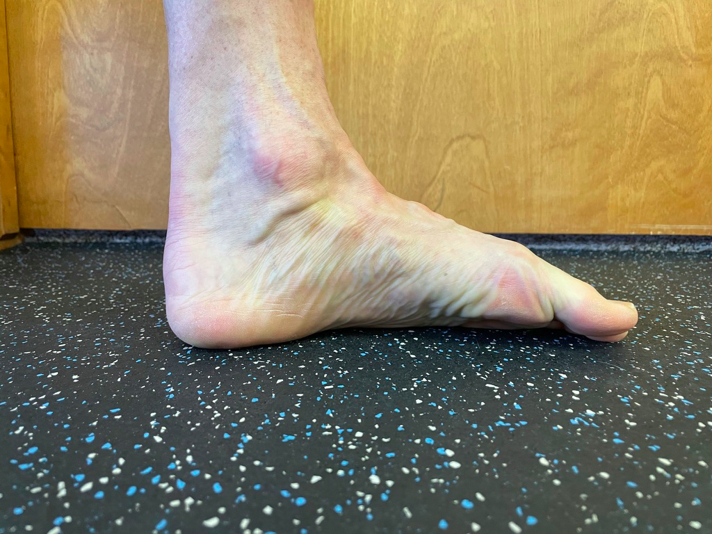 The Time to Improve Foot Function is Now — Sapphire Physical Therapy ...