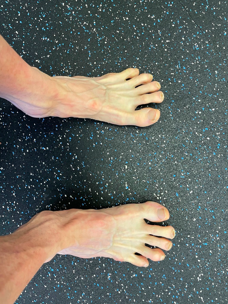 The Time to Improve Foot Function is Now — Sapphire Physical Therapy ...