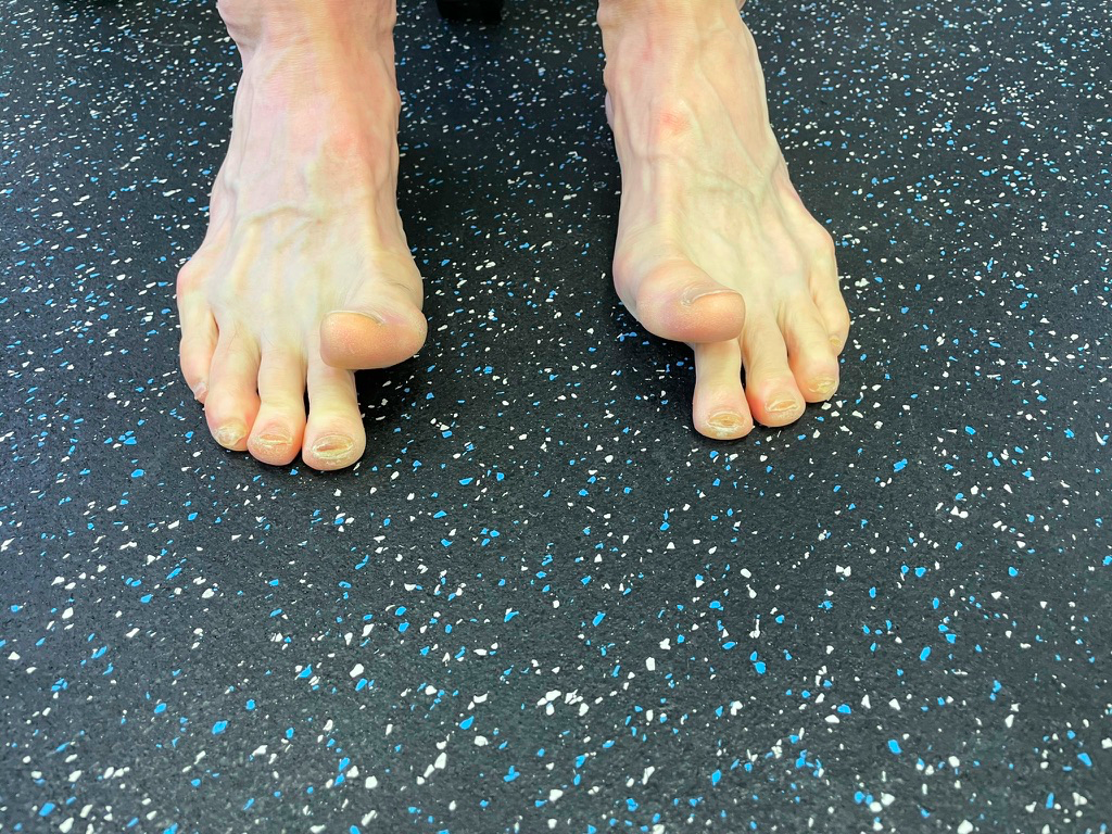 The Time to Improve Foot Function is Now — Sapphire Physical Therapy ...