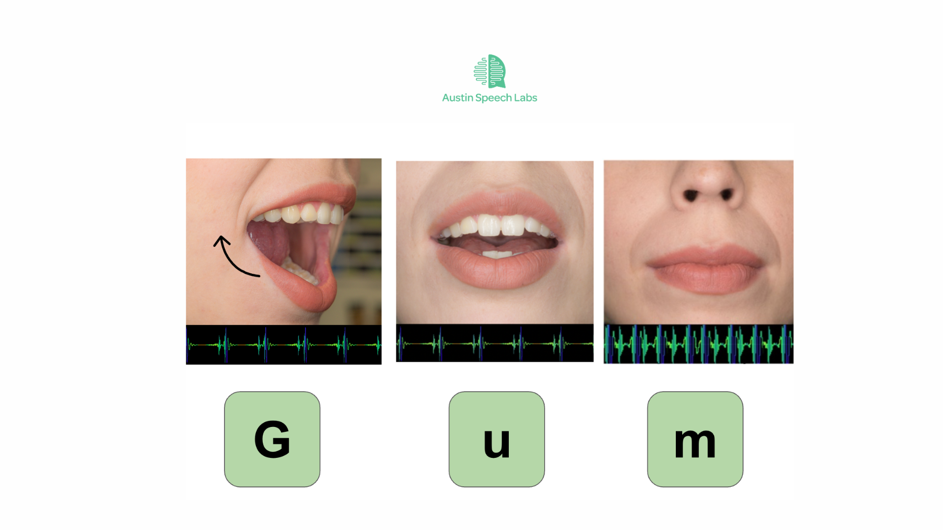 General 2 — Austin Speech Labs