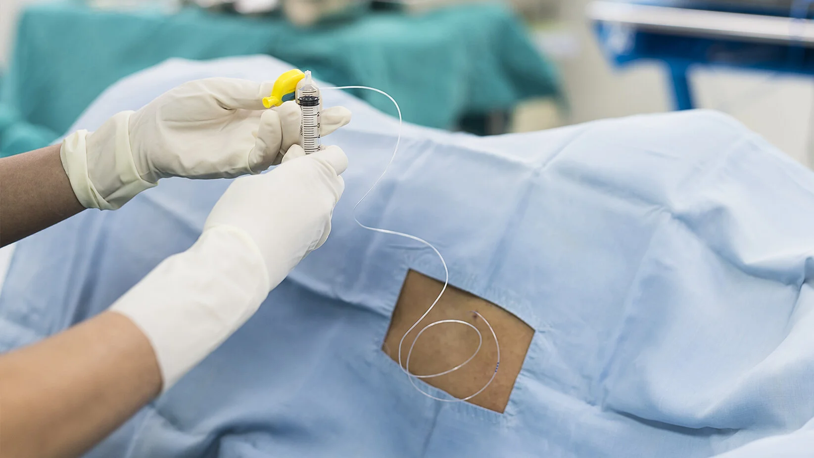 Analgesia Epidural — UaCuida