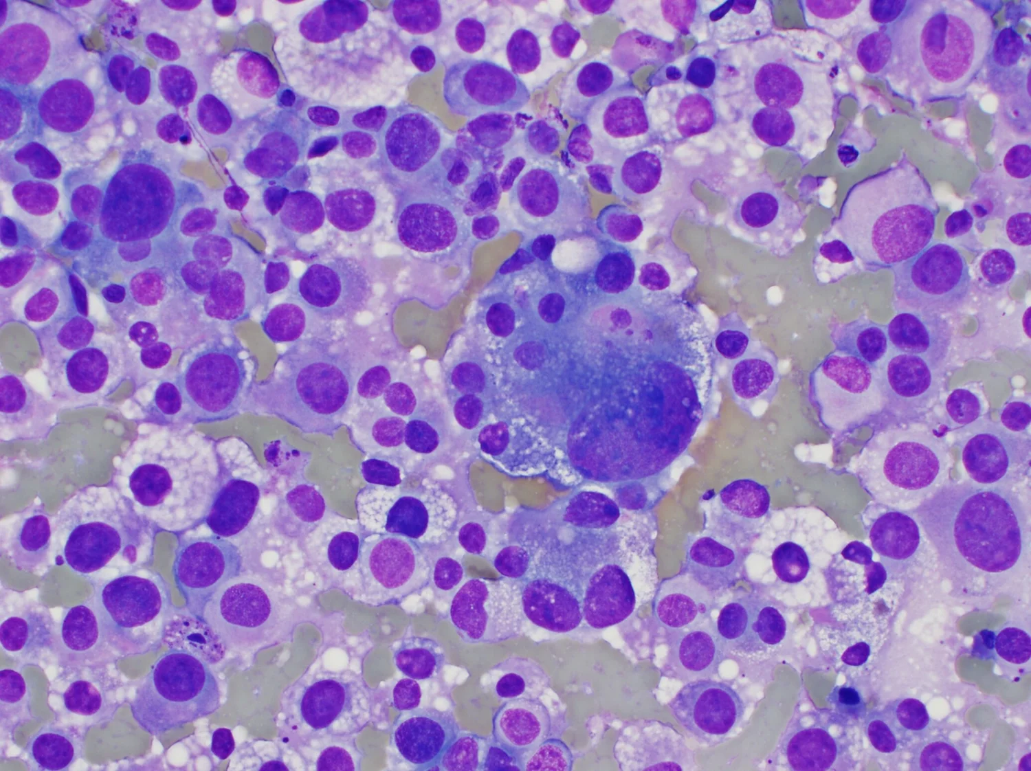 Cytopathology — PathElective