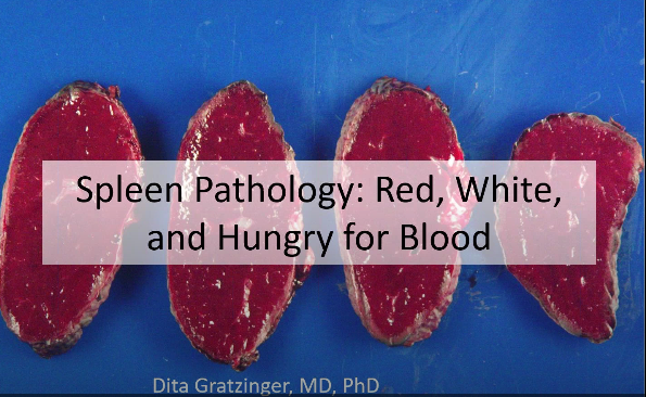 Hematopathology Lesson 3 — PathElective