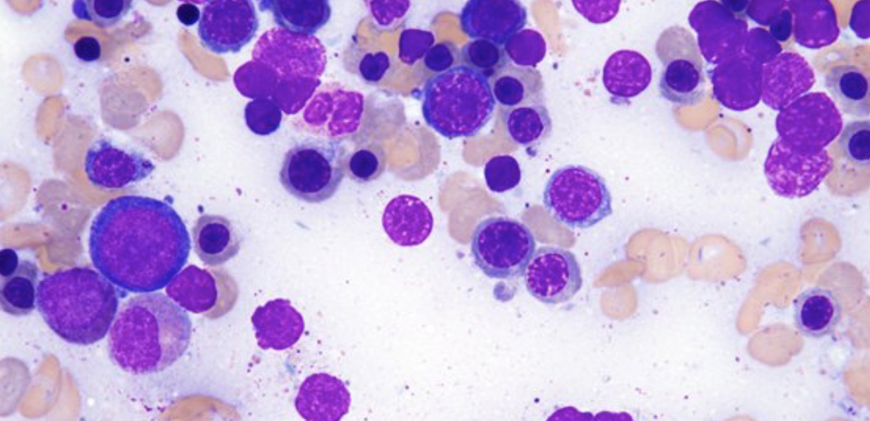 Hematology Lesson 3 — PathElective