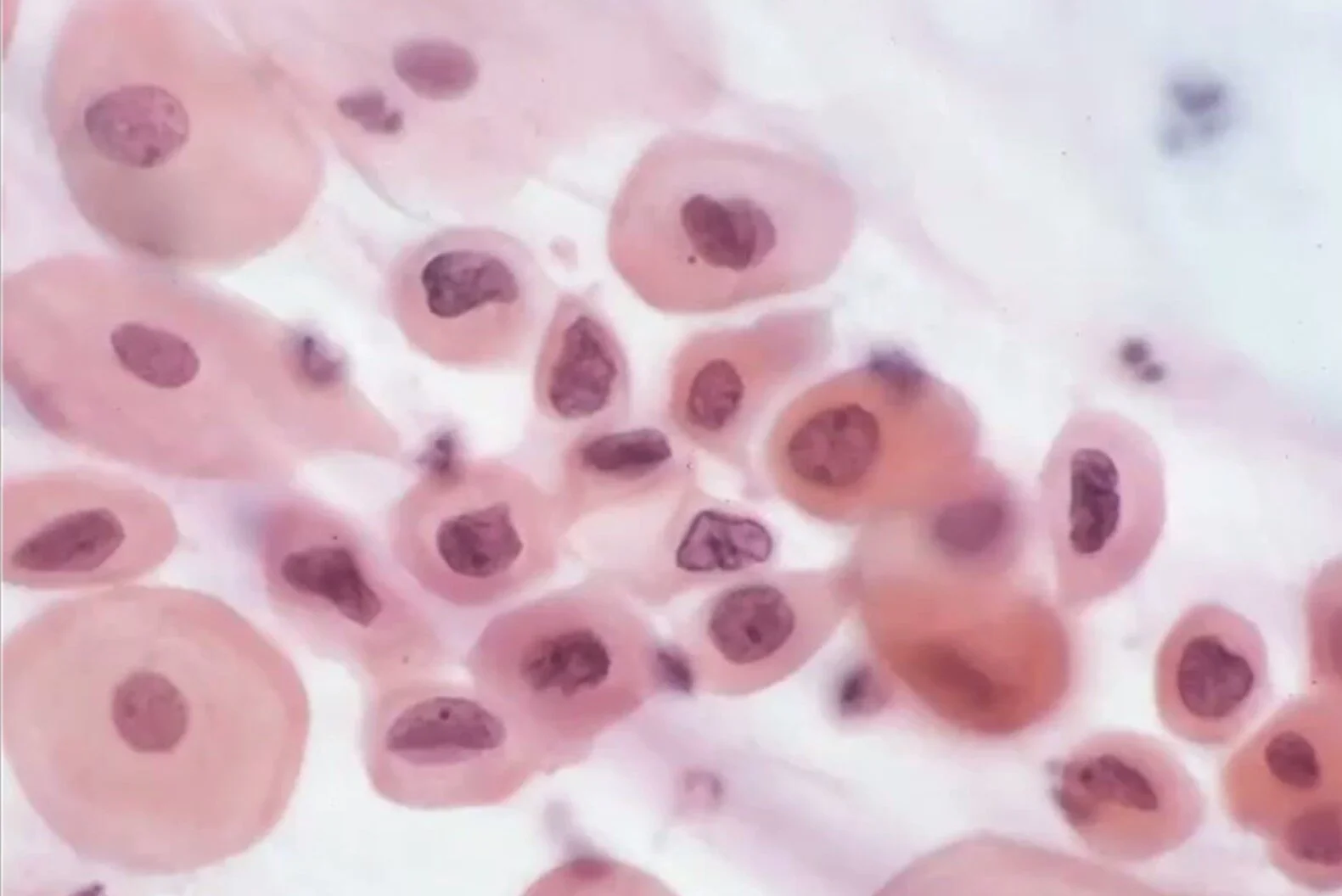 Cytopathology Lesson 5 — PathElective