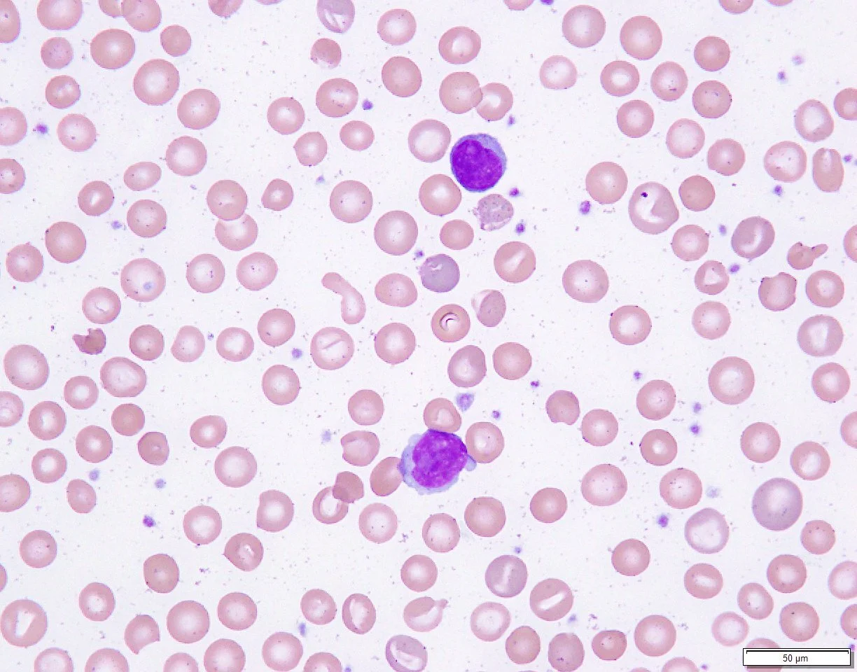 Hematology Lesson 1 — PathElective