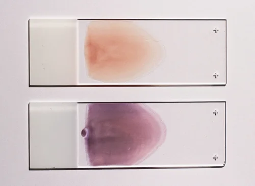Hematology Lesson 2 — PathElective