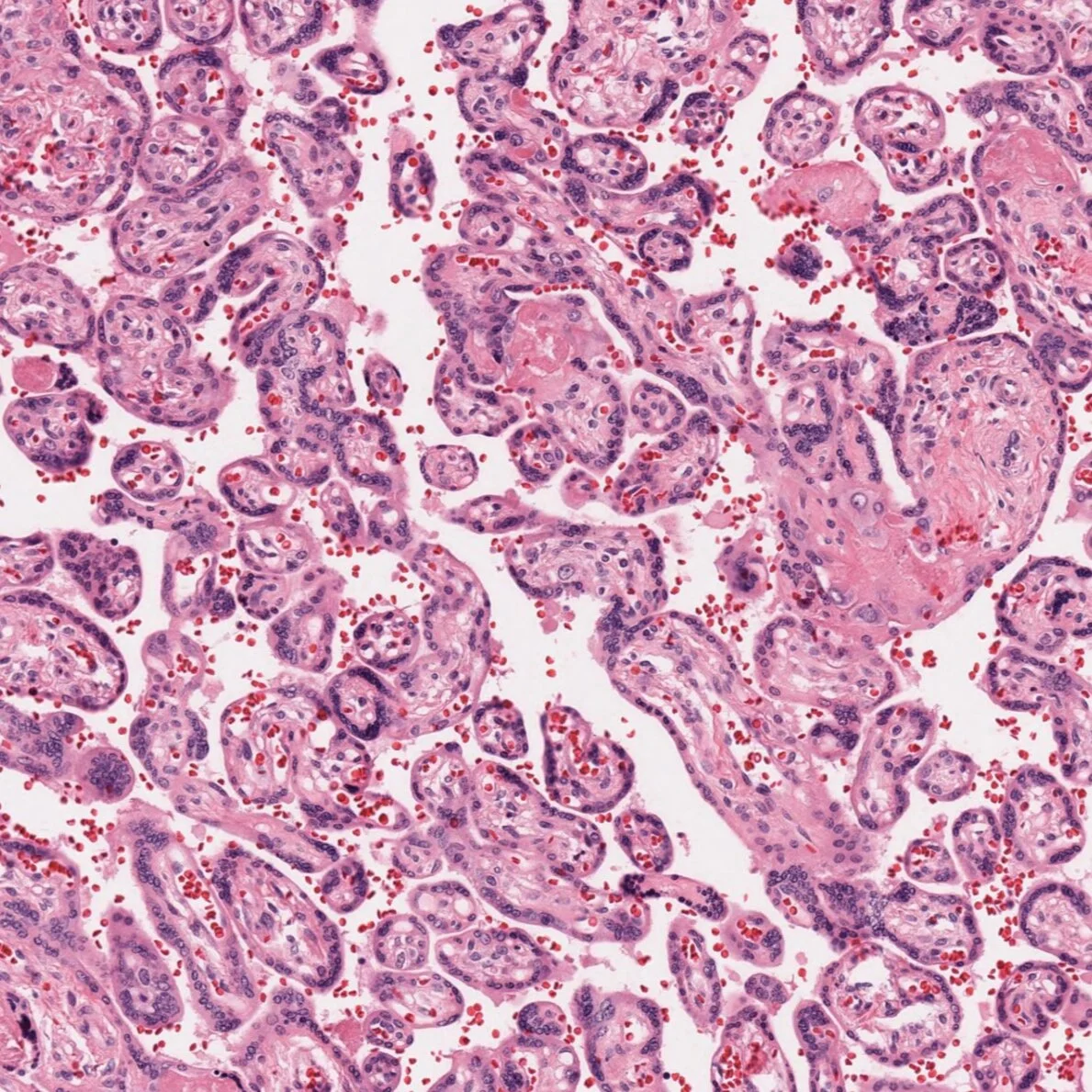 Pediatric Pathology — PathElective