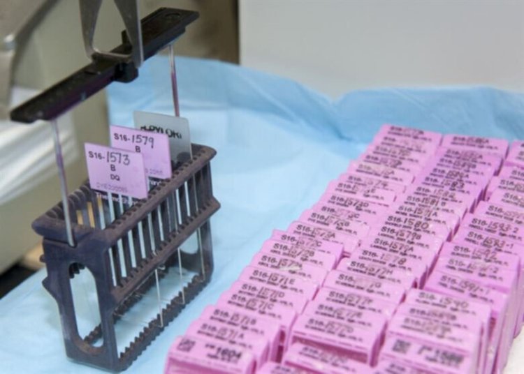 Intro to Anatomic Pathology — PathElective