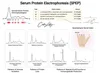 Serum Protein Electrophoresis and Immunofixation Electrophoresis (SPEP ...