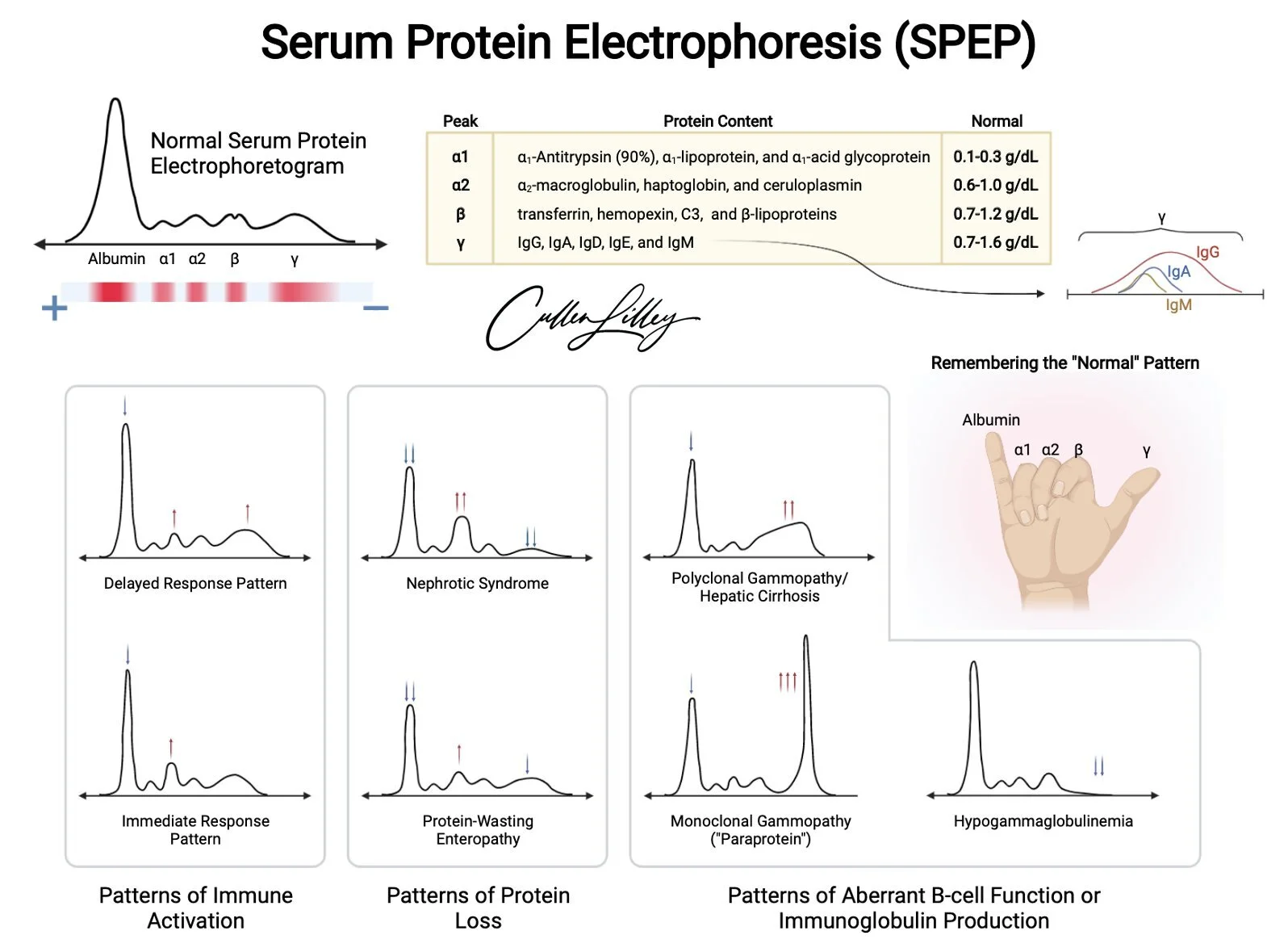 Serum Protein Electrophoresis And Immunofixation Electrophoresis SPEP