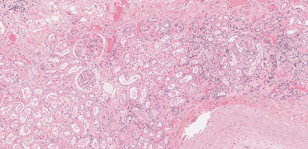 Medical Renal Pathology Lesson 1: Introduction to renal pathology ...
