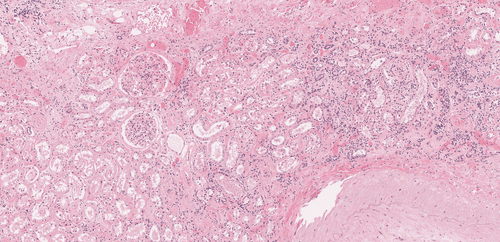 Medical Renal Pathology Lesson 1: Introduction to renal pathology ...
