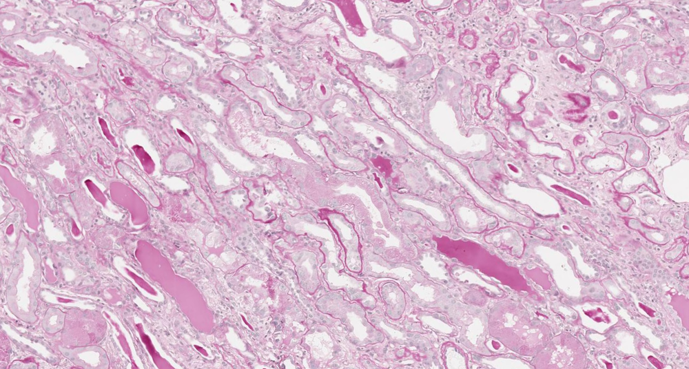 Medical Renal Pathology Home — PathElective