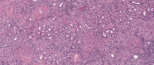 Medical Renal Pathology Home — PathElective