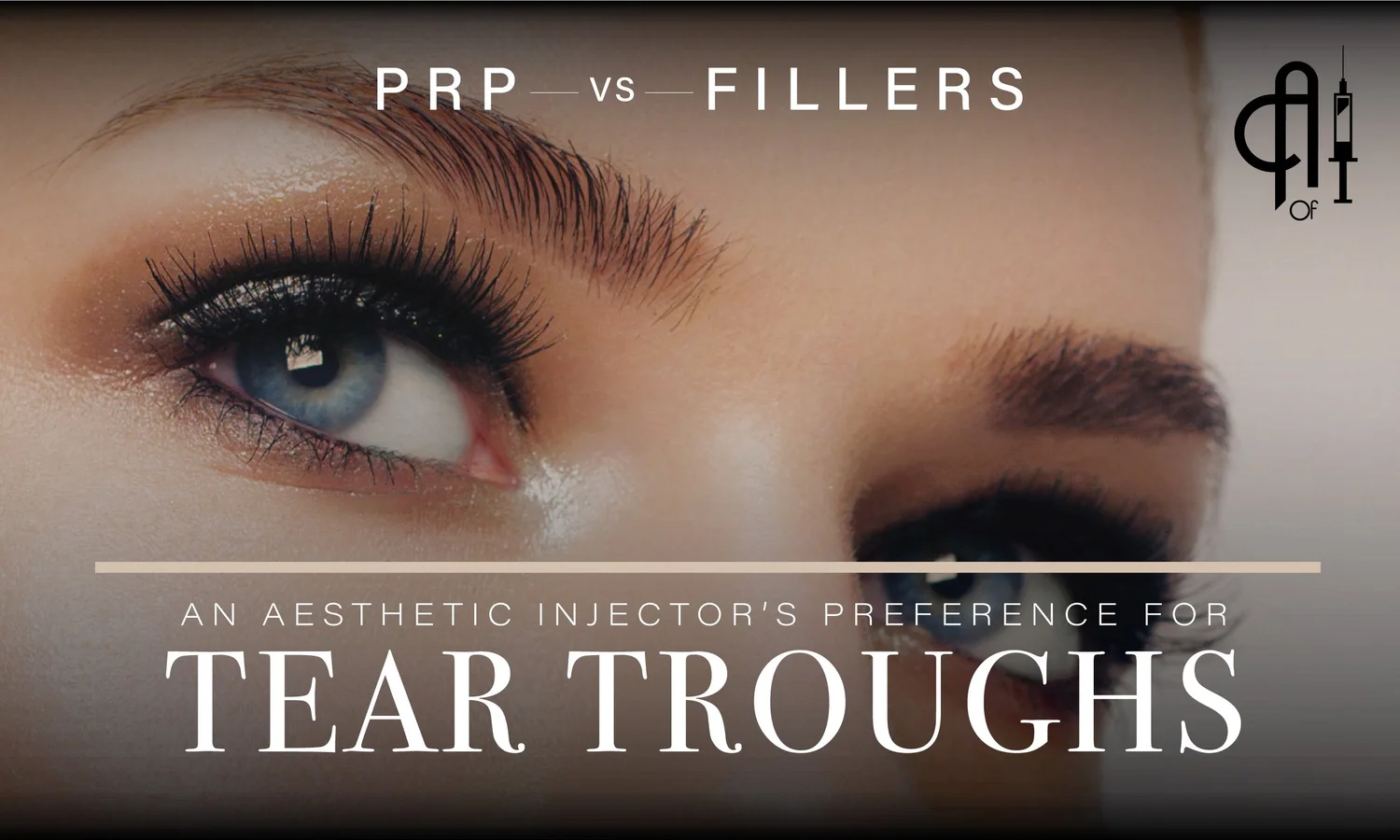 Tear Trough Hollows: Why I Recommend PRP Over Fillers — Art of Injection