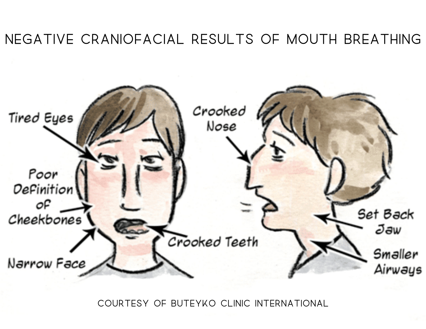 Natalia Plaza, COM® - Buteyko & OMT