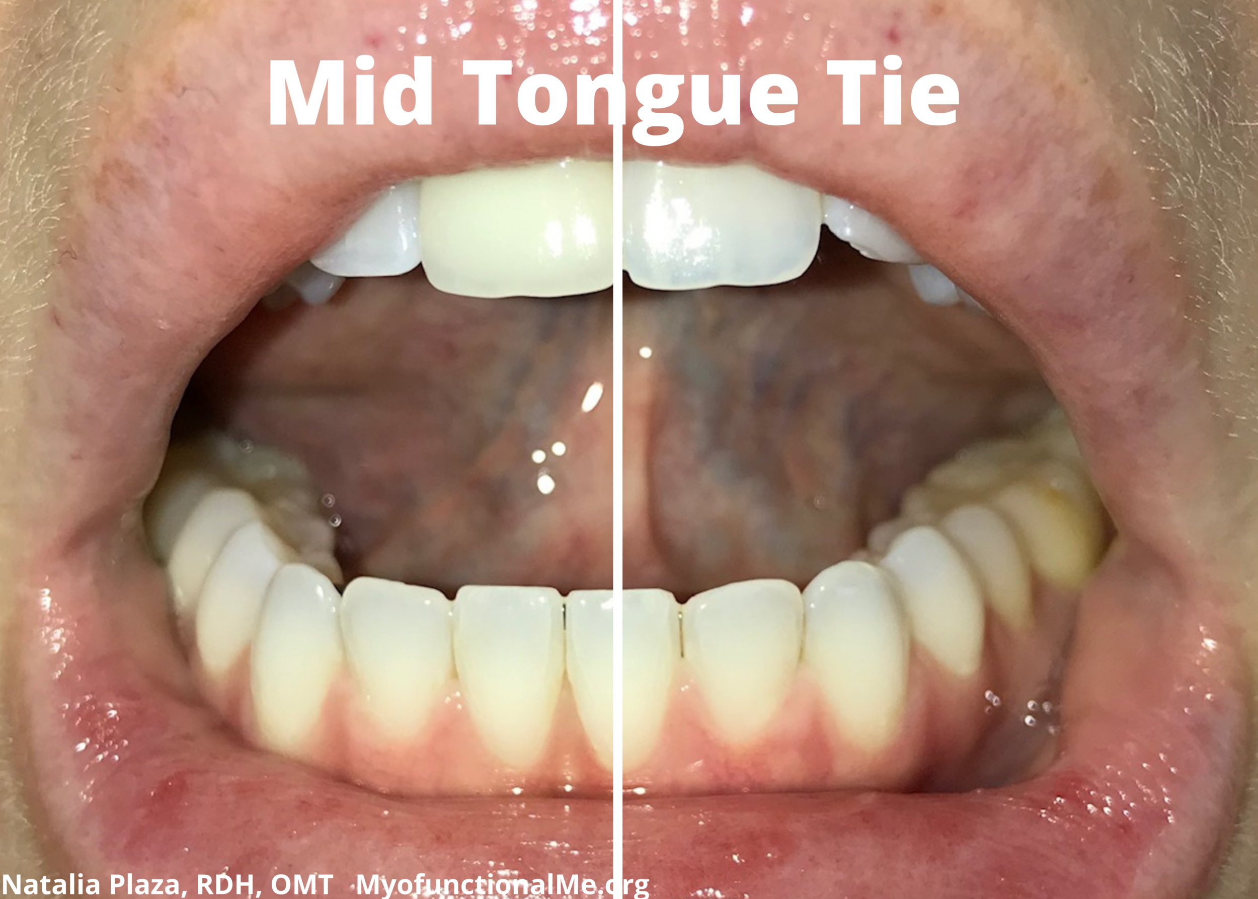 General 1 — Natalia Plaza, COM® - Buteyko & OMT