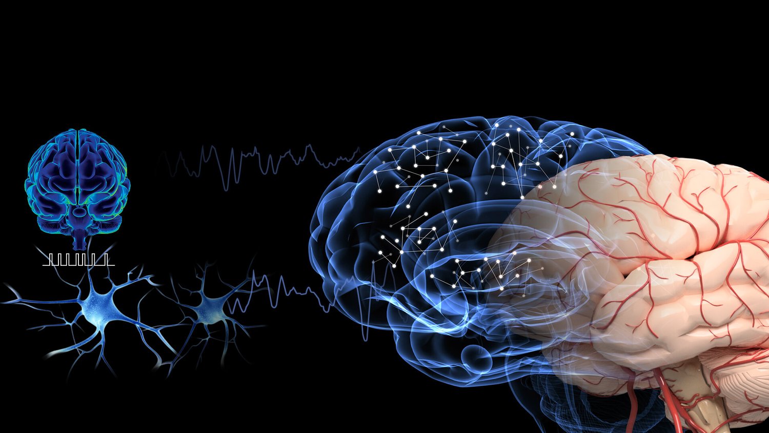 Brain Health Leadership Foundation
