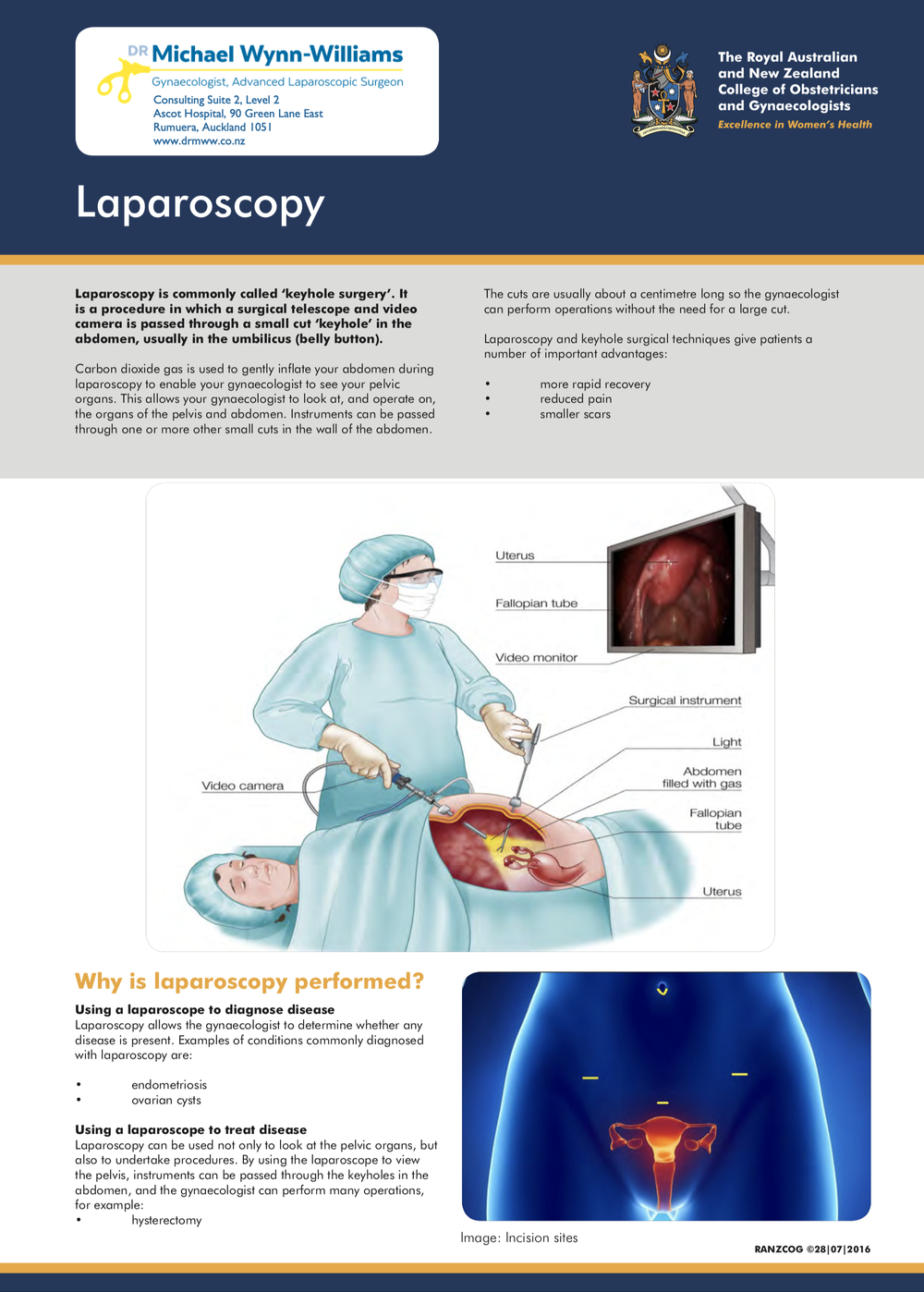 Laparoscopy | Keyhole Surgery — Dr Michael Wynn-Williams