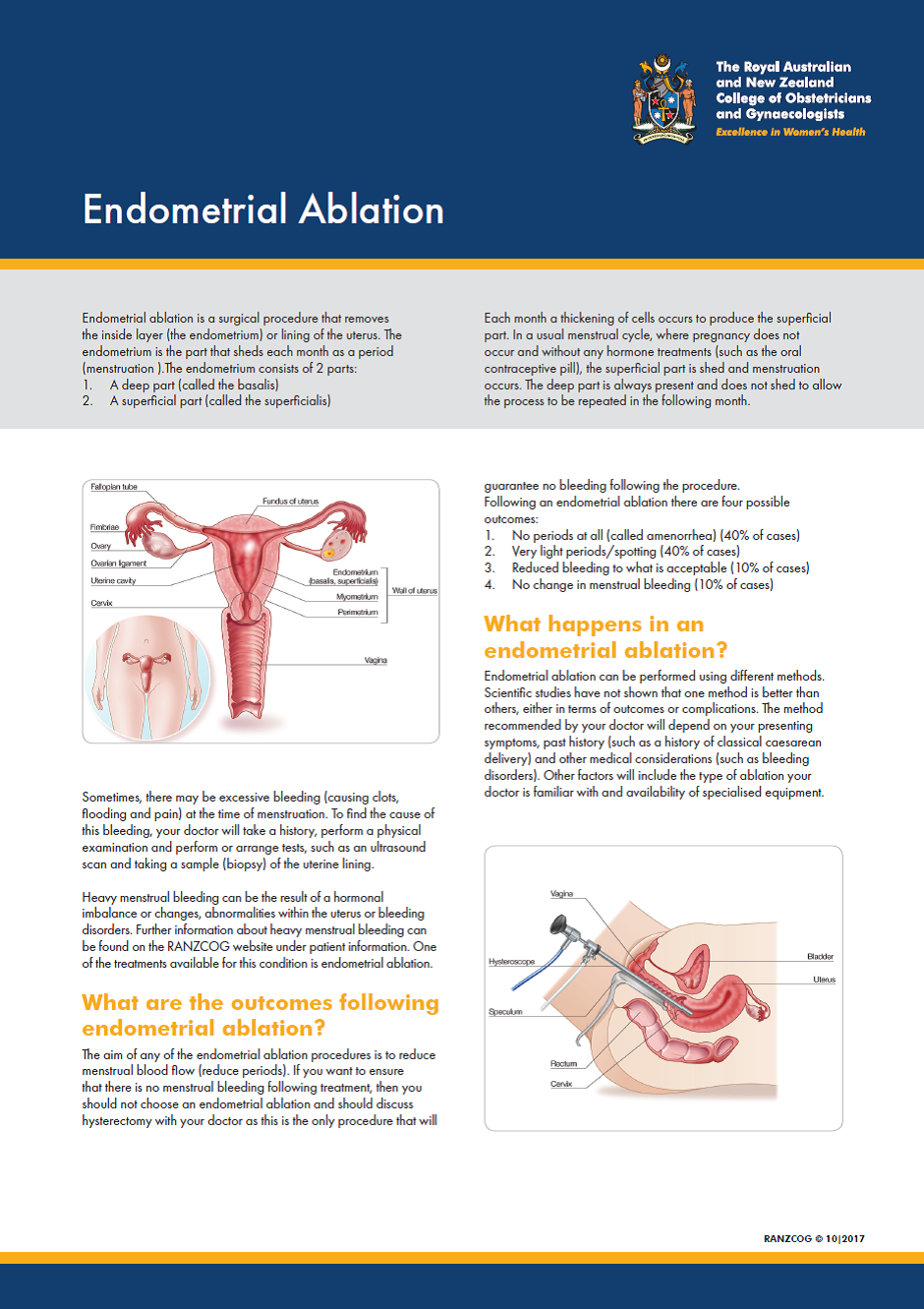 Endometrial Ablation Dr Michael Wynn Williams