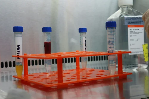 How to Read Your NMR LipoProfile Test Results | Precision Health Reports