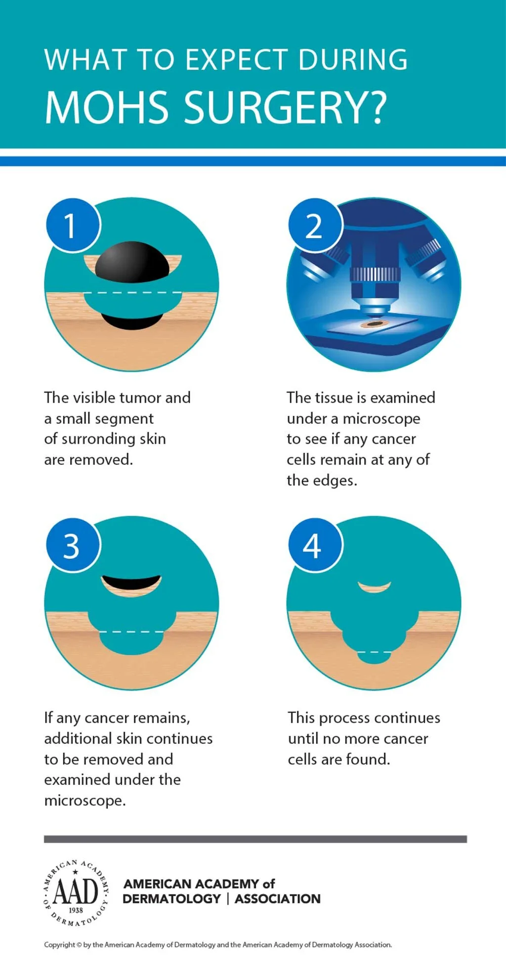 Mohs Surgery — Ozark Dermatology