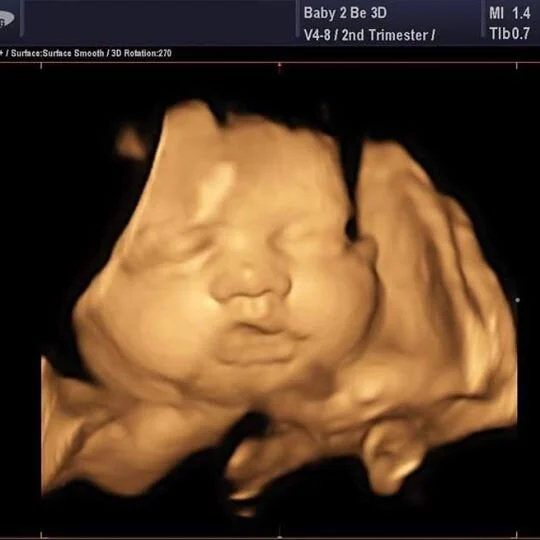 ULTRASOUND SESSIONS — Baby To Be 3D
