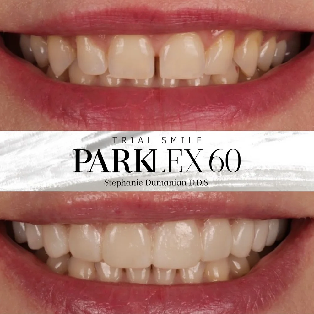General 2 — Park Lex 60 Dental