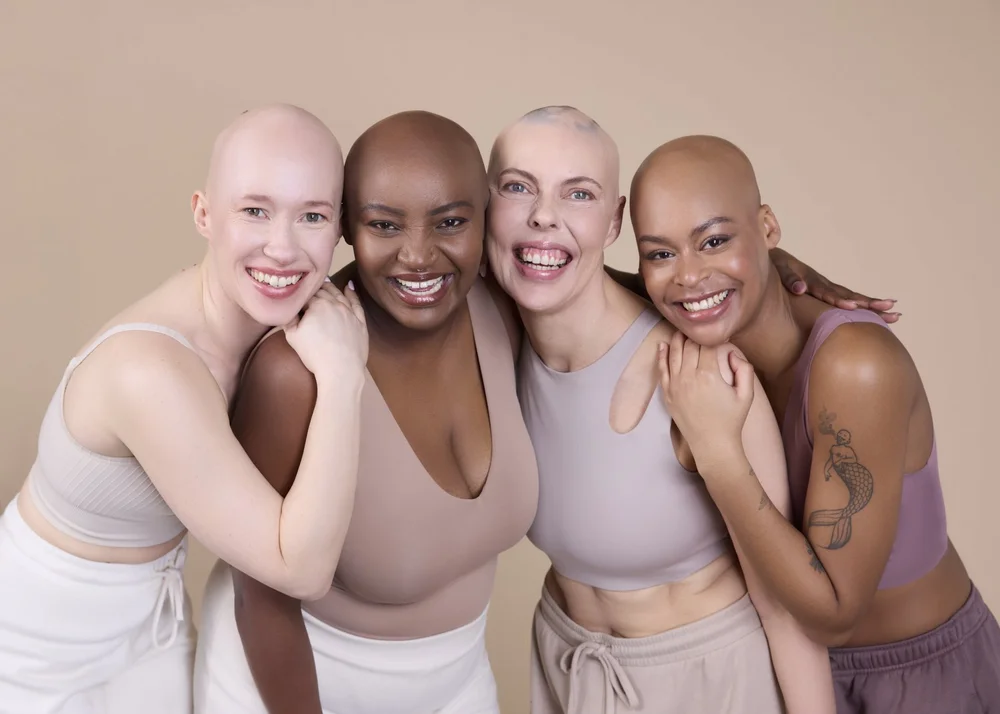 Alopecia Project — Tilly Nelson Commercial Lifestyle & Kids Fashion ...