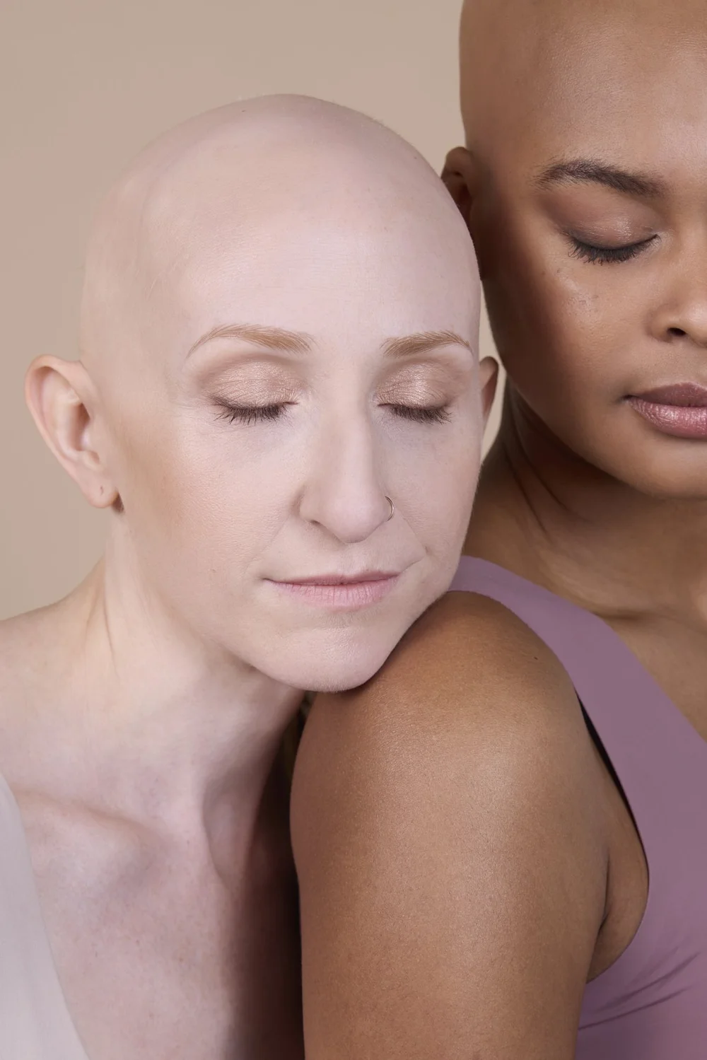 Alopecia Project — Tilly Nelson Commercial Lifestyle & Kids Fashion ...
