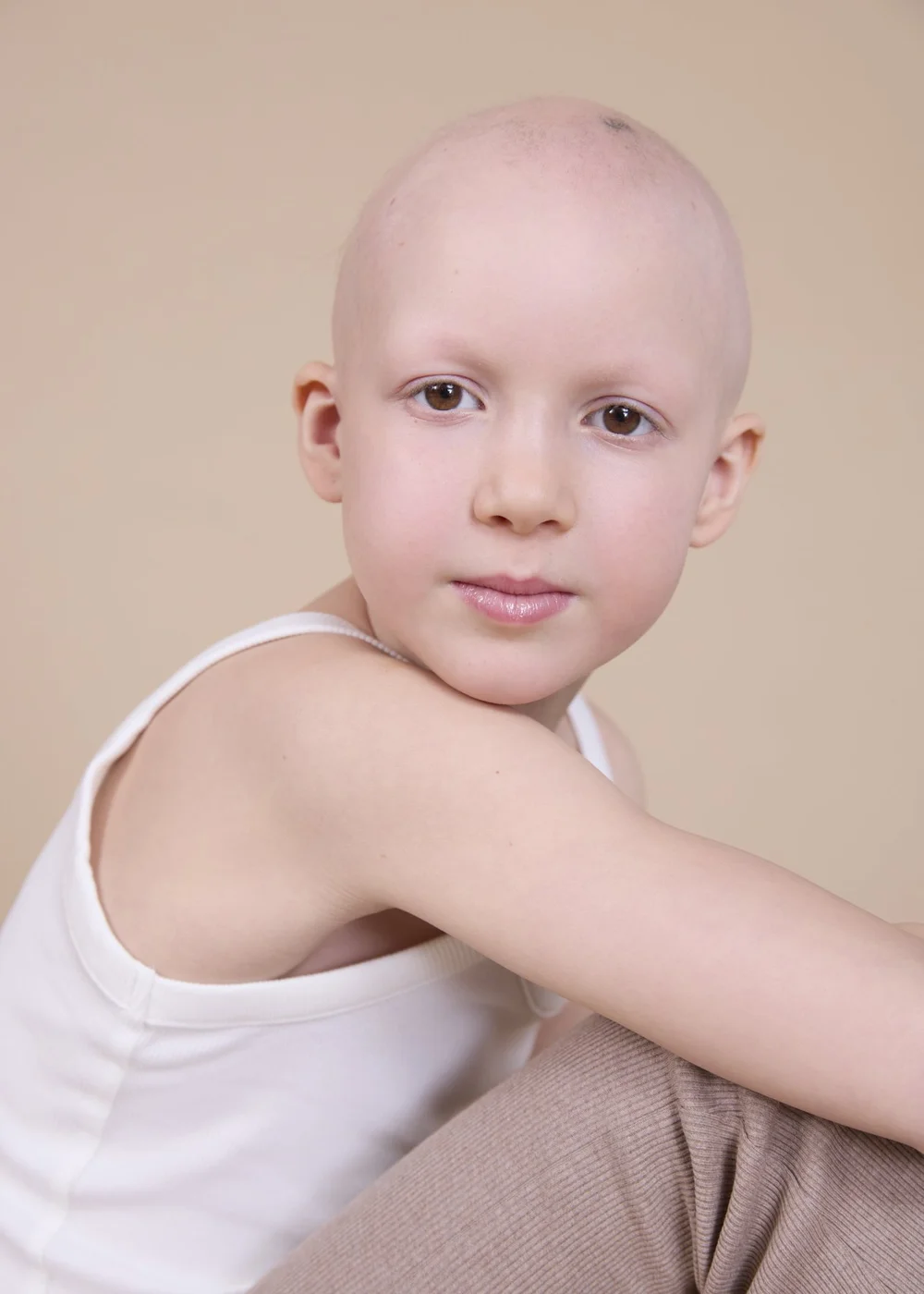 Alopecia Project — Tilly Nelson Commercial Lifestyle & Kids Fashion ...